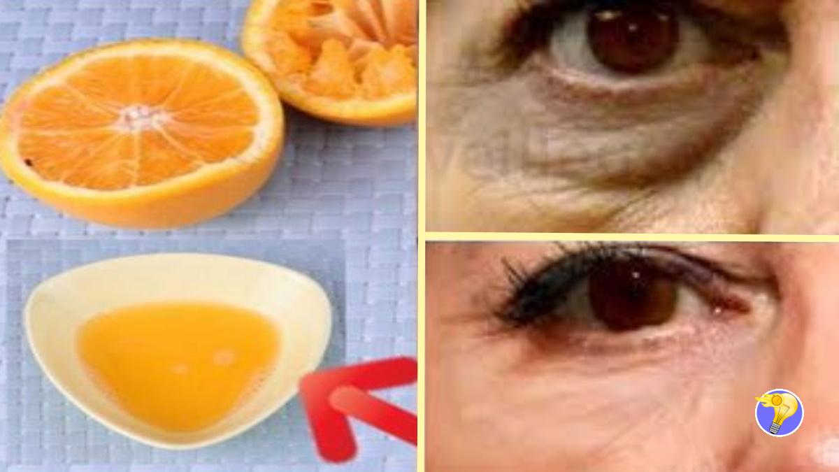 Comment Eliminer les Cernes Avec un Seul Ingrédient