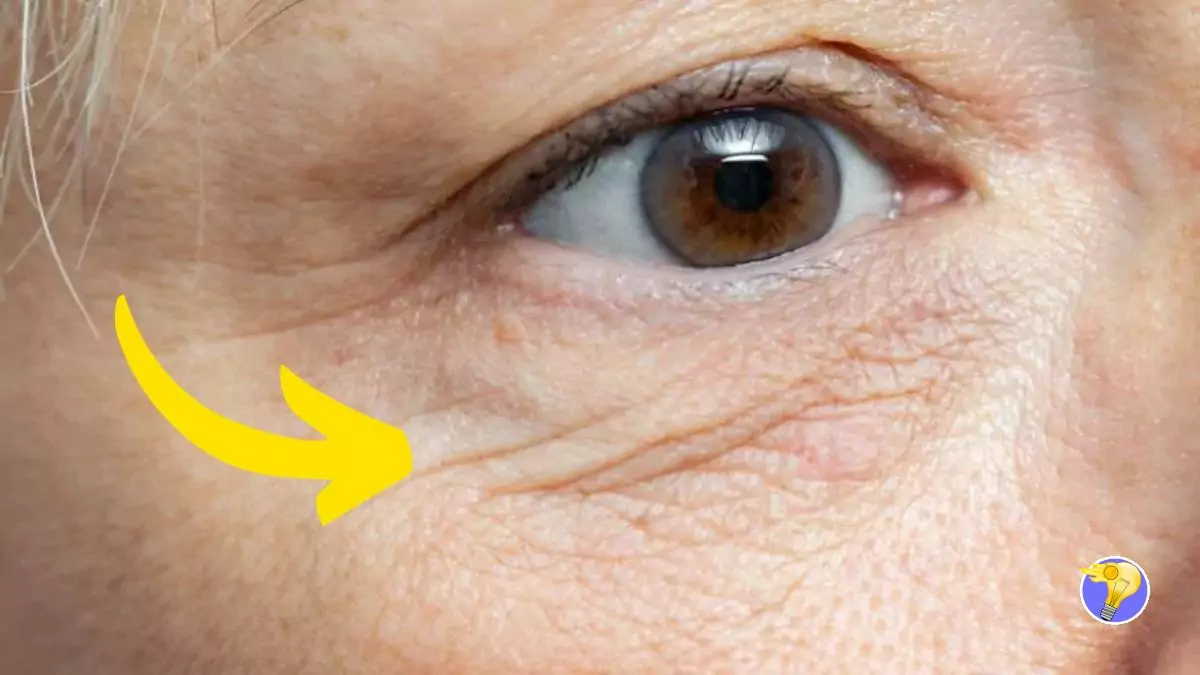 Contour Des Yeux: Une Technique Pour Les Rajeunir